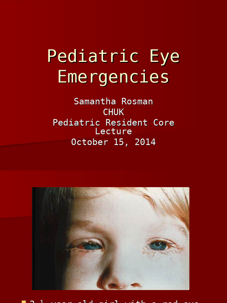 Pediatric Eye Emergencies Overview | PDF | Causes Of Death | Medical ...