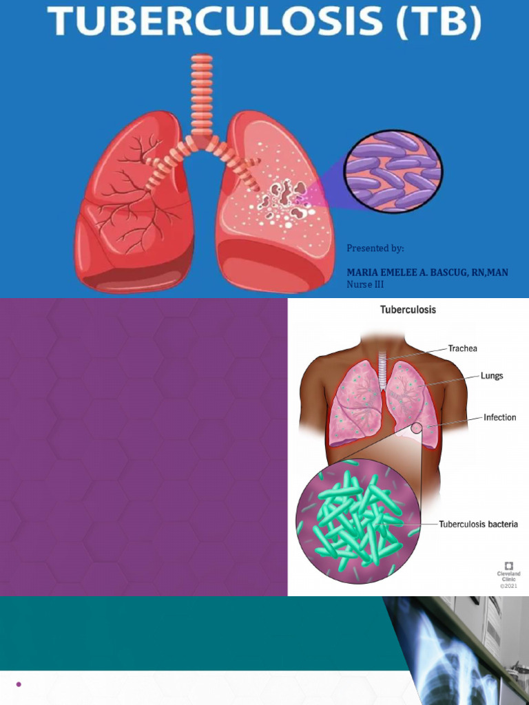 PTB Dec 2024 | PDF | Tuberculosis | Clinical Medicine