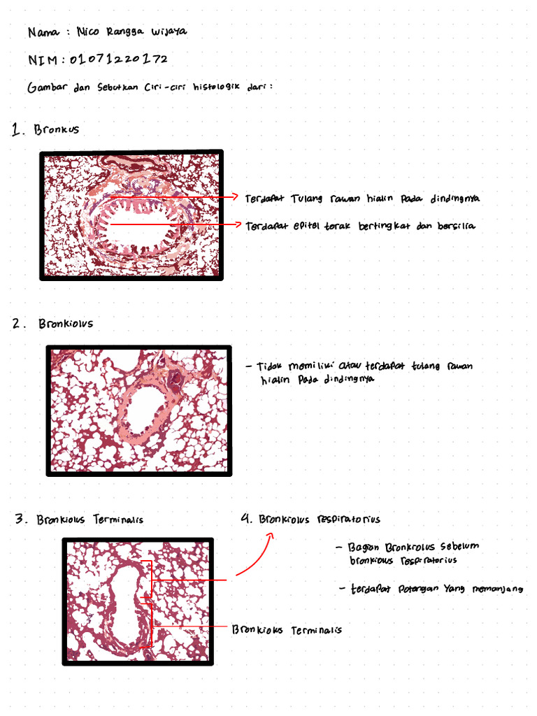 tugas Histo Blok Respi | PDF
