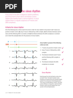 Abnormal Arterial Line Waveforms - Deranged Physiology | PDF | Blood ...