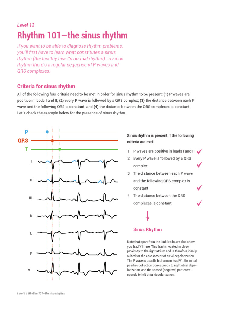 Rhythm 101-The Normal Rhythm - Fact Sheet | PDF | Electrocardiography ...