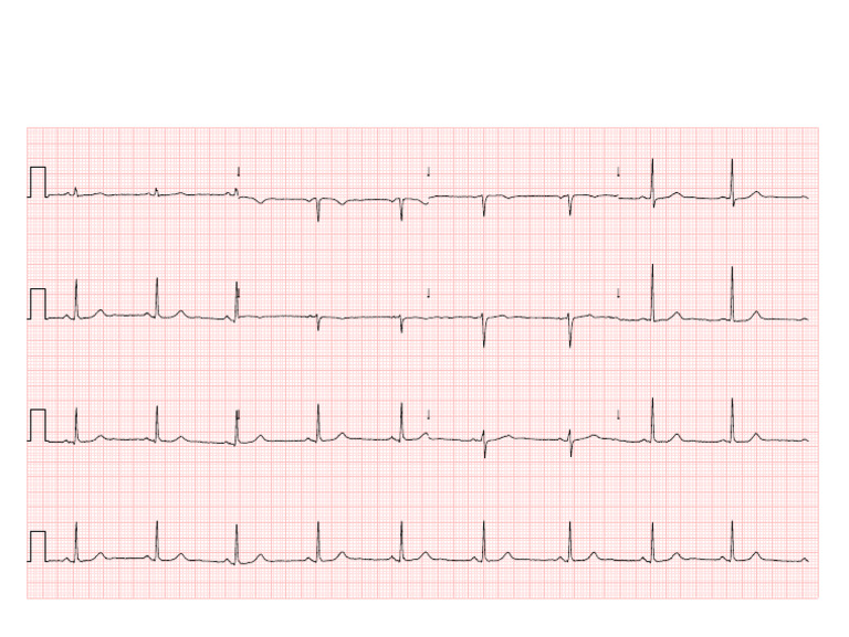 R^ECG^_0_^Pires^Solange^_20250118180253_20250118172614 | PDF