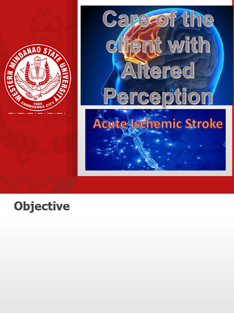 Acute Ischemic Stroke | PDF | Stroke | Ischemia
