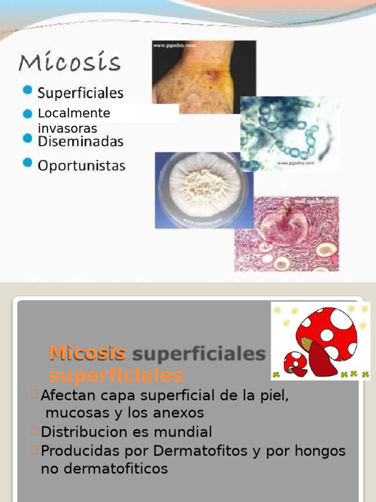 Micosis Superficial - 2 | PDF | Enfermedades animales | Enfermedades y ...