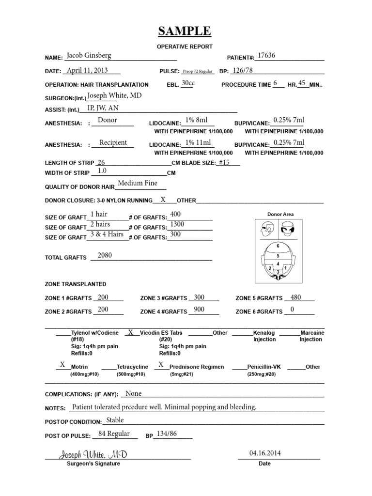 Hair Transplant Surgery Report | PDF | Medicine | Medical Treatments