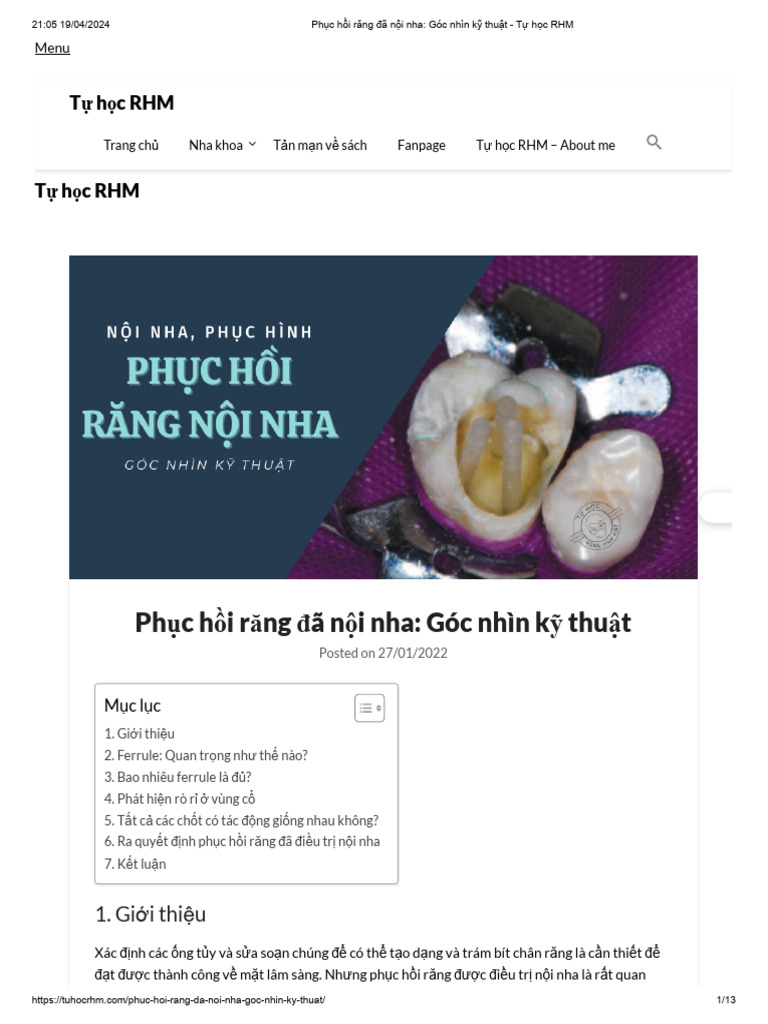 Phục hồi răng đã nội nha - Góc nhìn kỹ thuật - Tự học RHM | PDF
