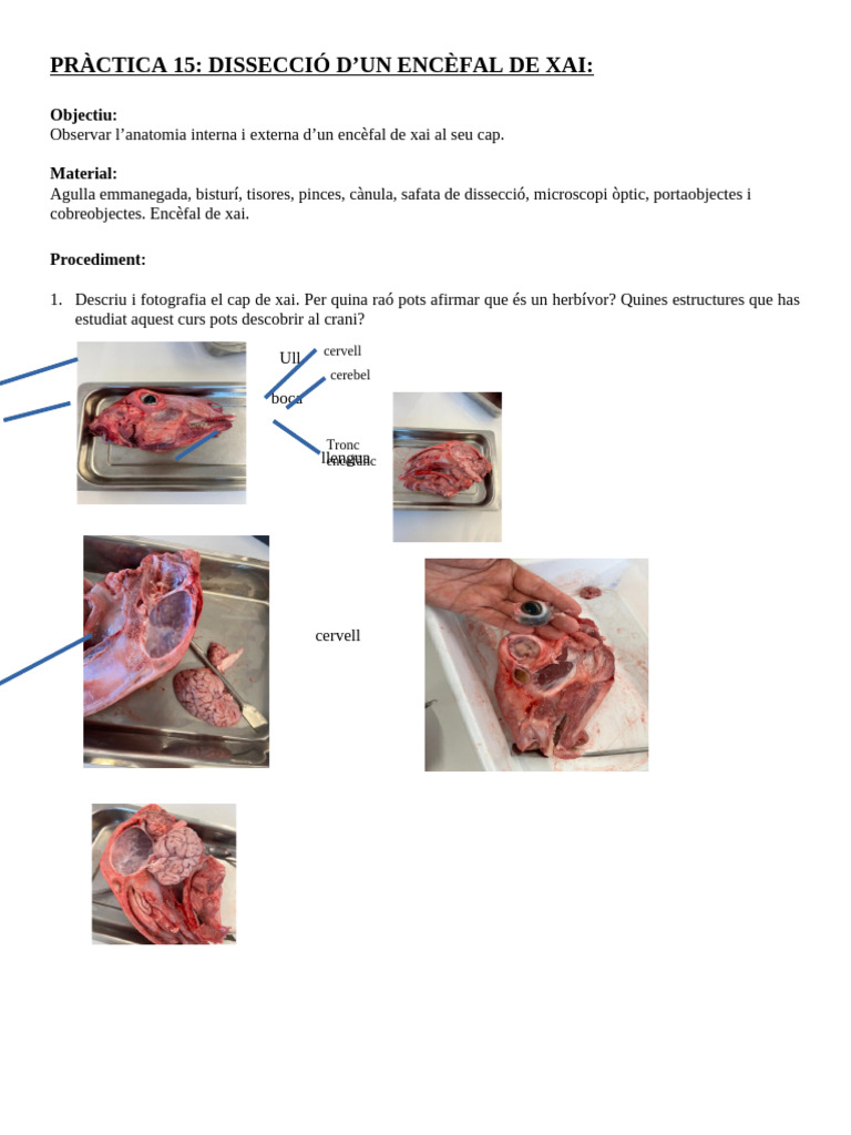 7971 20240604 Exercici 16 Practica16 Disseccio Encefal Al Crani | PDF