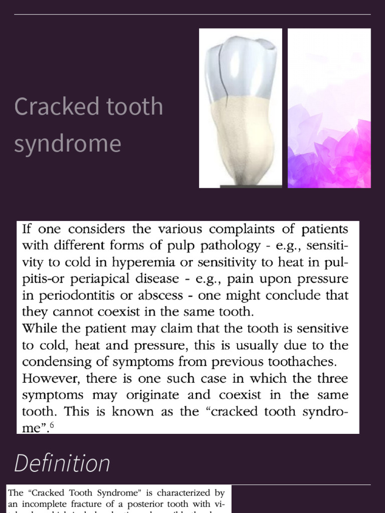Cracked Tooth Syndrome | PDF
