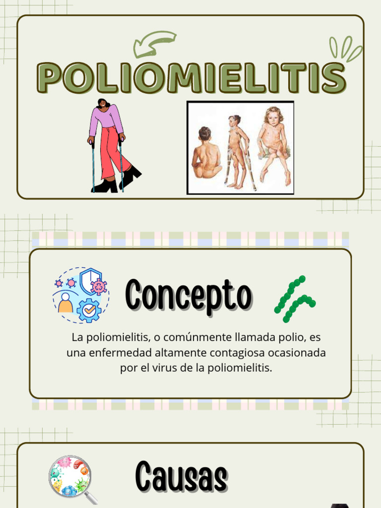 Poliomielitis | PDF
