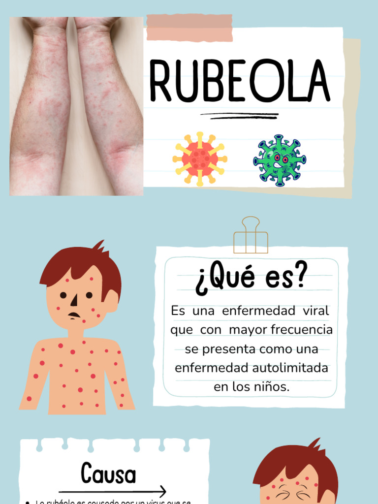 Rubéola: Guía para Padres y Cuidadores | PDF