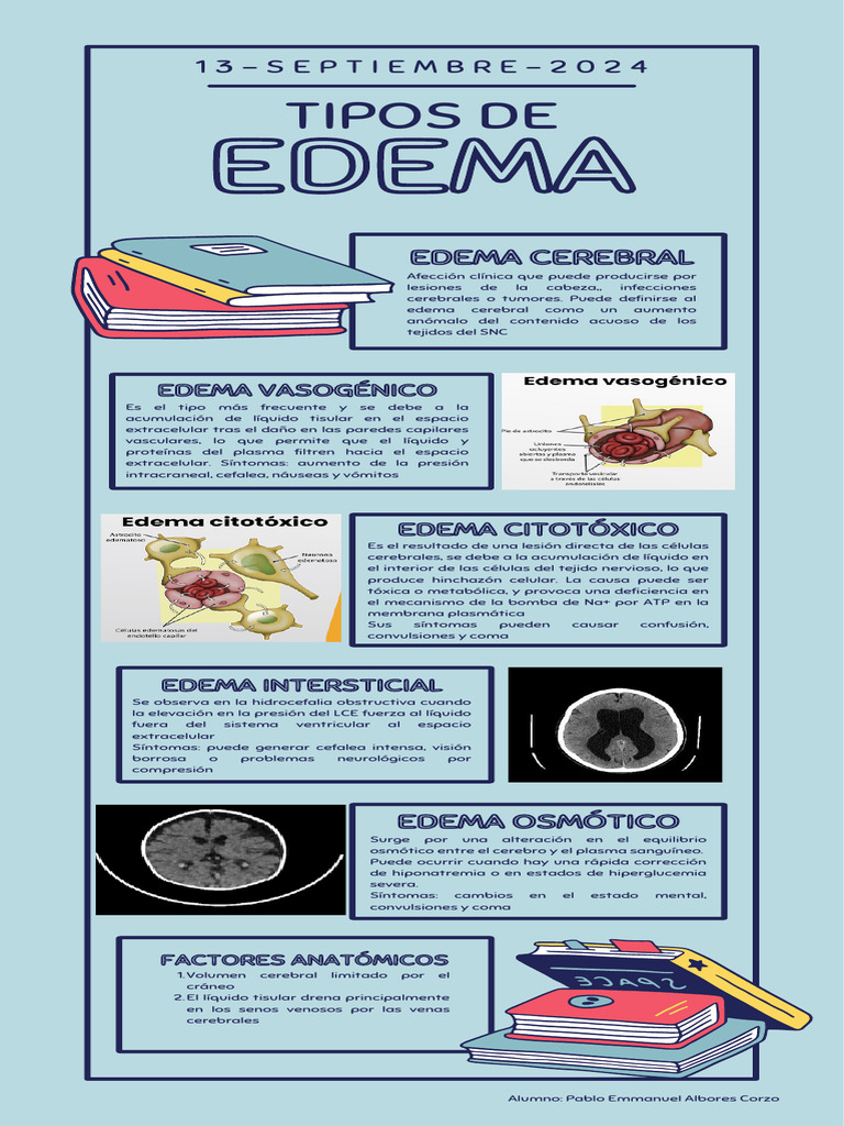 4. Tipos de Edema | PDF | Edema | Enfermedades y trastornos