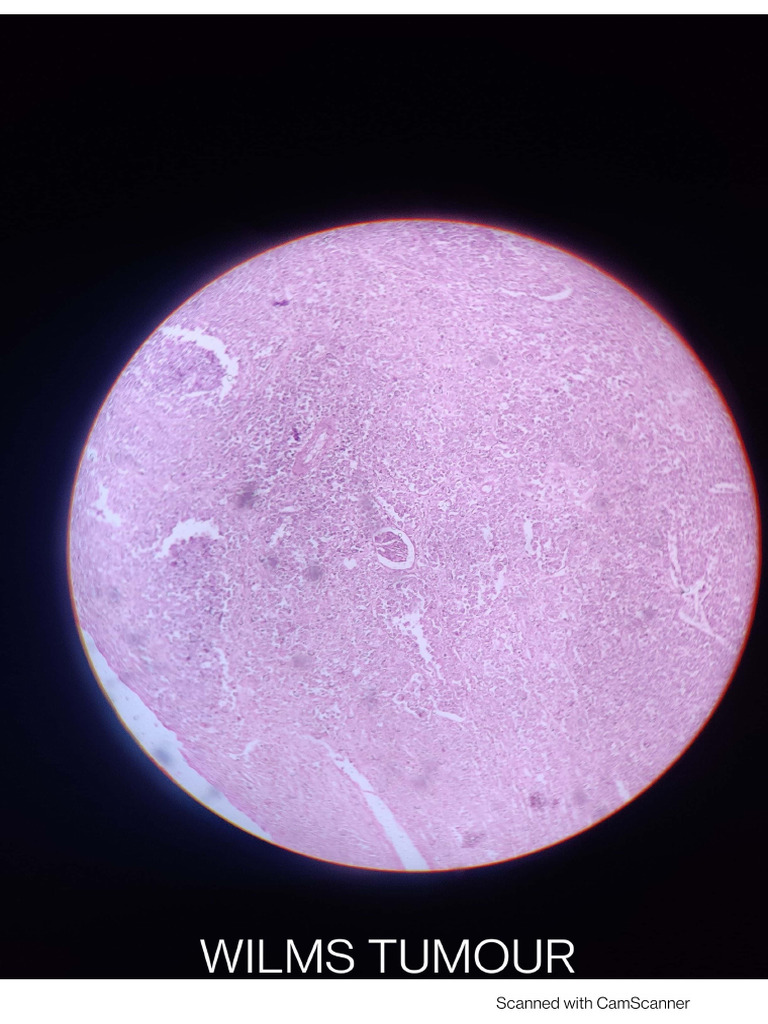 Patho Spottings | PDF