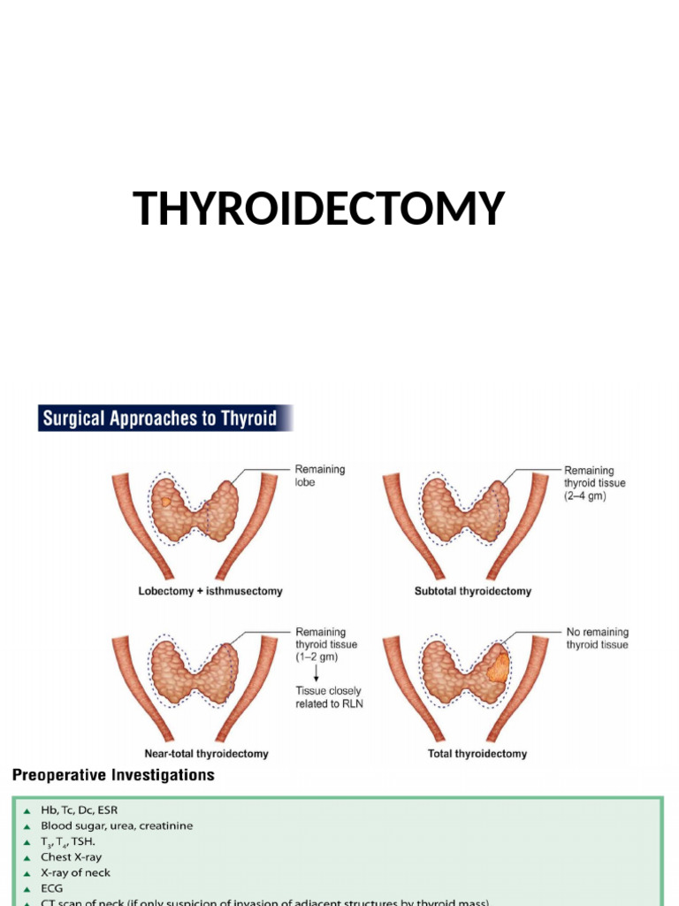 Thyroidectomy | PDF