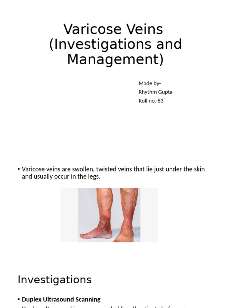 Varicose Veins-1 | PDF | Vein | Varicose Veins