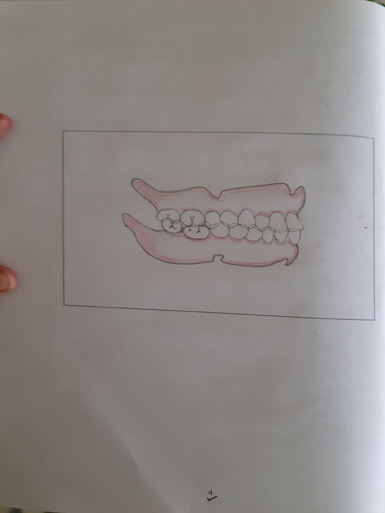 Preclinical Prostho Journal Sep 2021 | PDF | Dentures | Human Head And Neck
