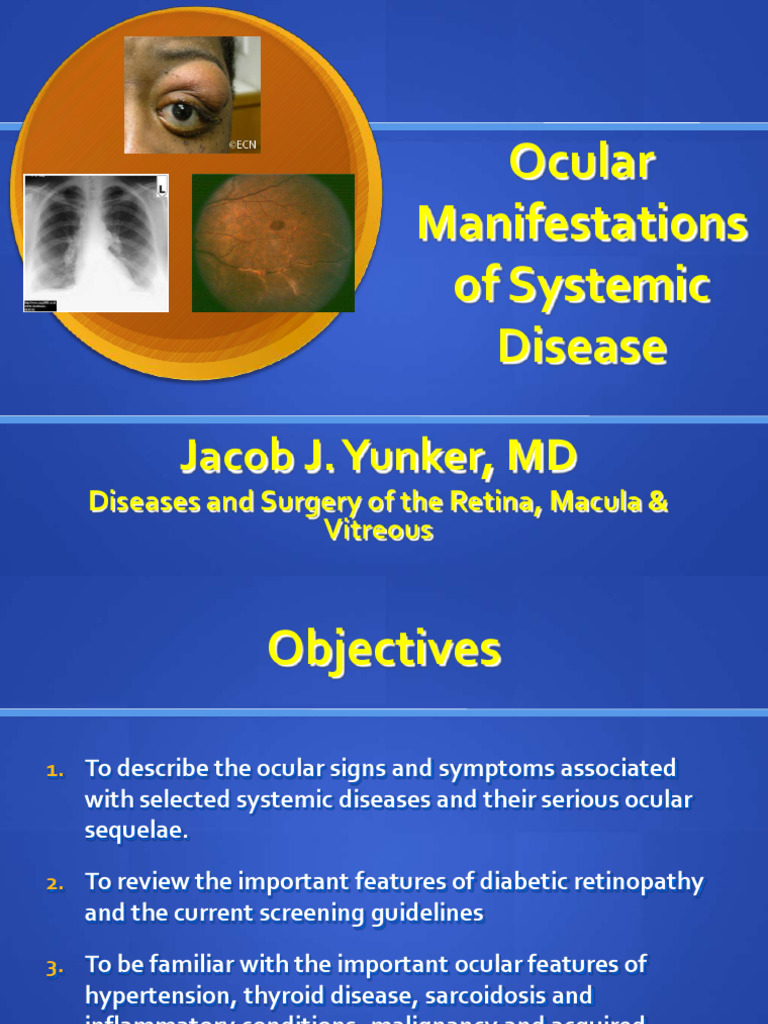 Ocular Signs of Systemic Diseases | PDF | Causes Of Death | Human Eye