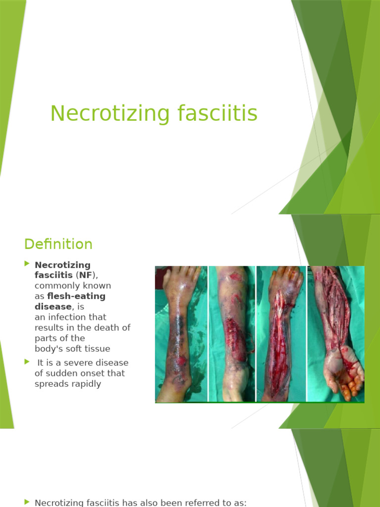 Necrotizing Fasciitis | PDF | Causes Of Death | Medicine