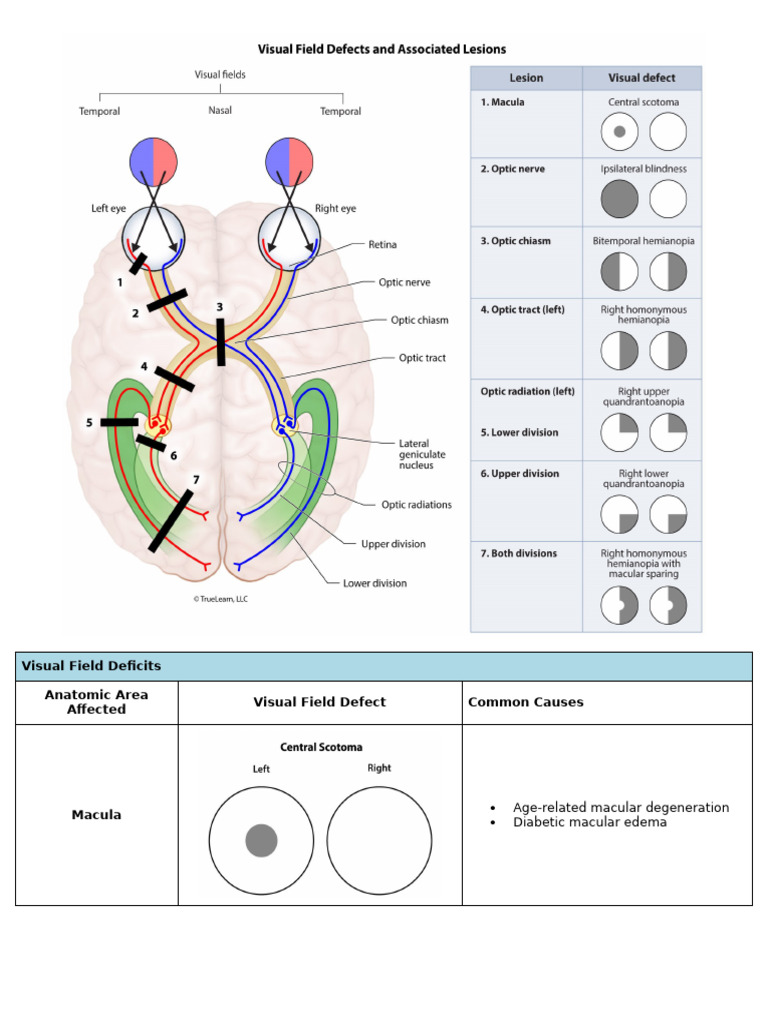 Visual Field Deficits and Causes | PDF | Acetylcholine | Stroke