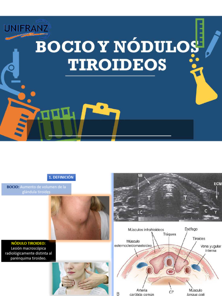 Bocio y Nódulos Tiroideos: Guía Clínica | PDF | Tiroides | Sistema ...