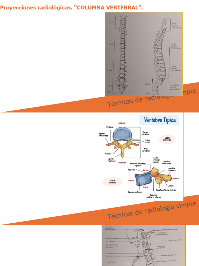 Proyecciones Radiológicas Columna Vertebral | PDF | La columna ...