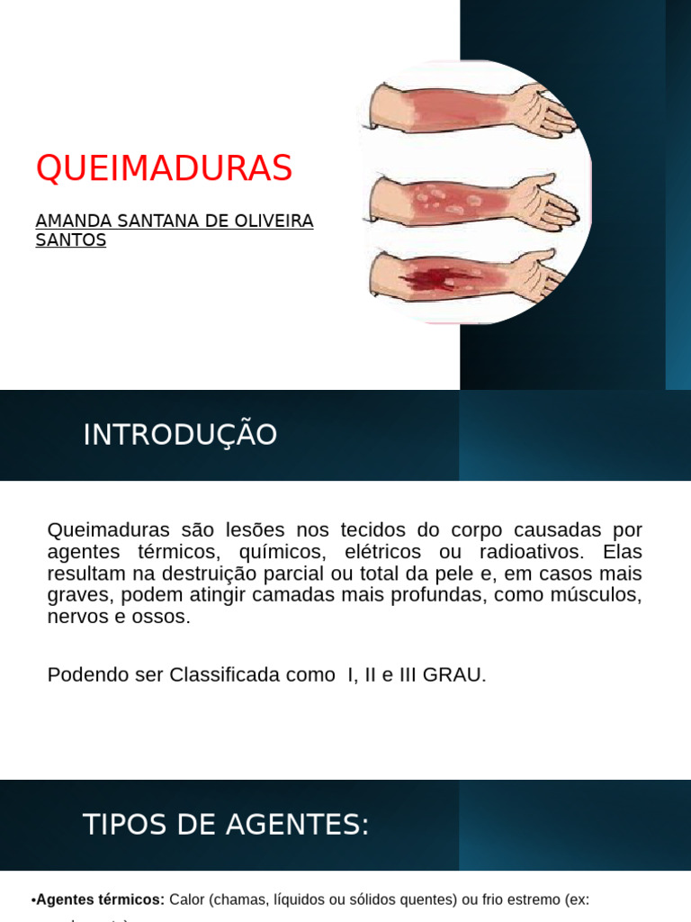 Apresentação - Queimaduras AMANDA | PDF | Queimadura | Radiação