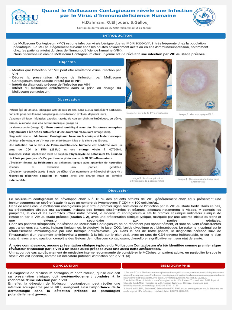 Mc-Vih Eposter-Smd 2024 | PDF | VIH | Maladies virales animales