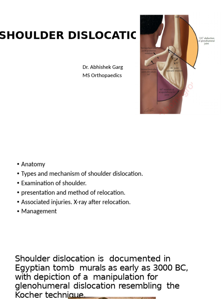 Shoulder Dislocation | PDF | Shoulder | Human Anatomy