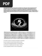Bula Atensina 0100mg Com 30 Comprimidos Boehringer 103 | PDF ...