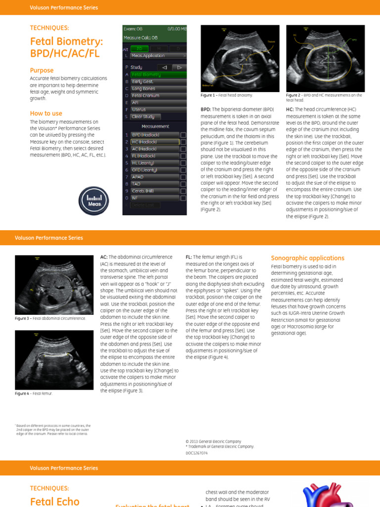 Voluson Performance - Quick Guide-Technique Cards - DOC1267074 ...