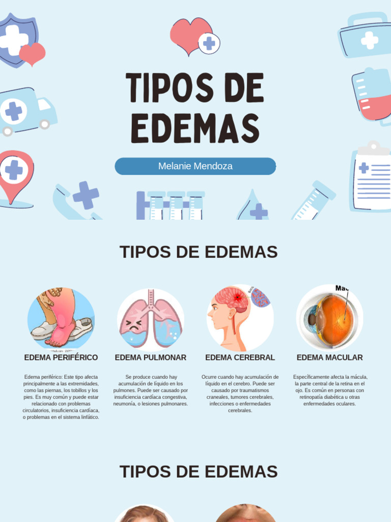 Tipos de Edemas: Guía Completa | PDF