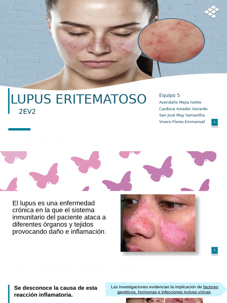 Lupus Eritematoso | PDF | Epidemiología | Especialidades Medicas
