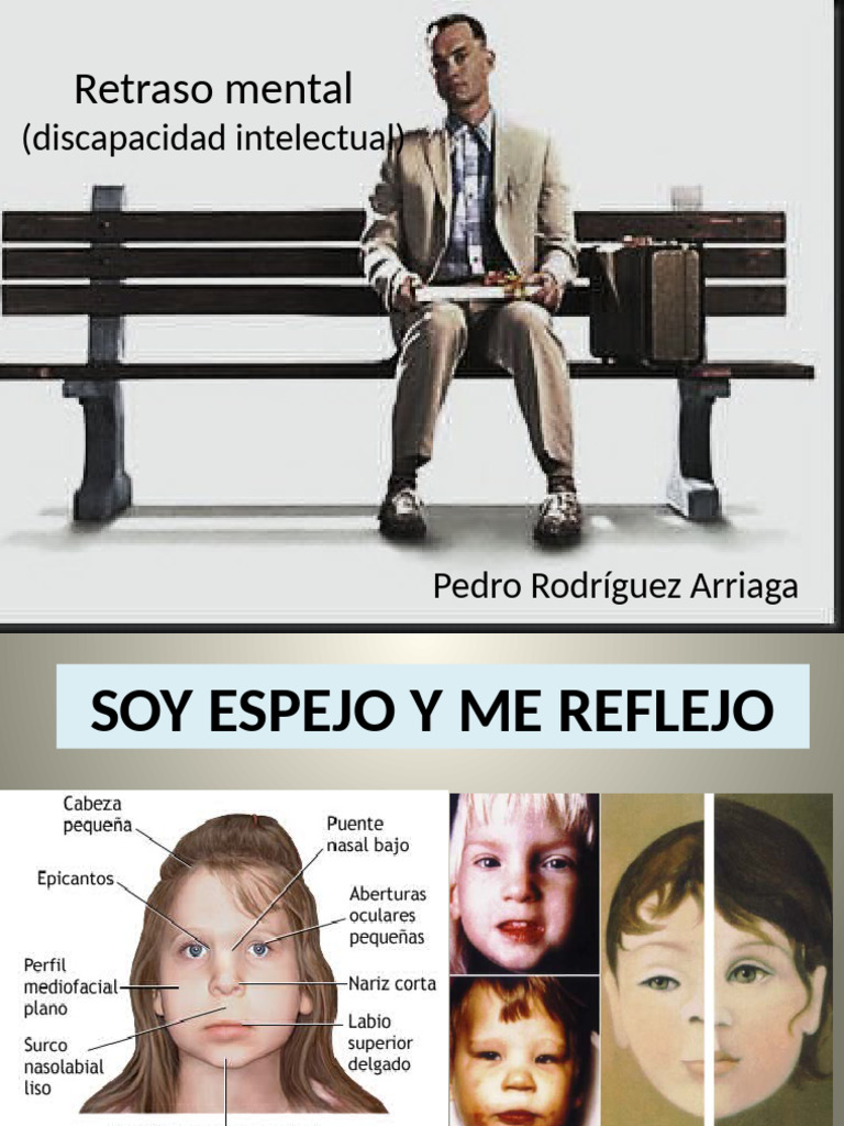 Retraso Mental: Diagnóstico y Tratamiento | PDF | Discapacidad ...