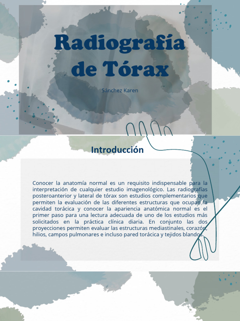 RX de Torax | PDF