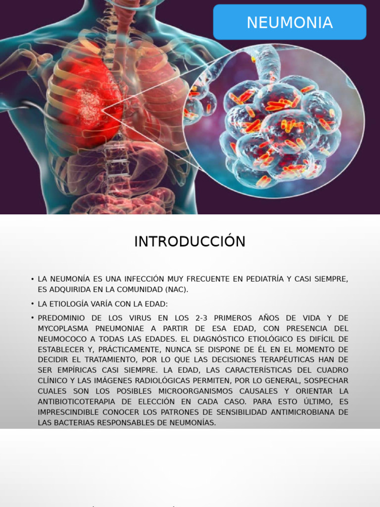 Neumonia | PDF | Neumonía | Enfermedades respiratorias
