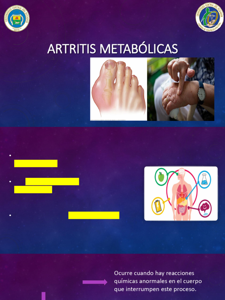 Artritis Metabólicas: Gota y Condrocalcinosis | PDF | Gota ...