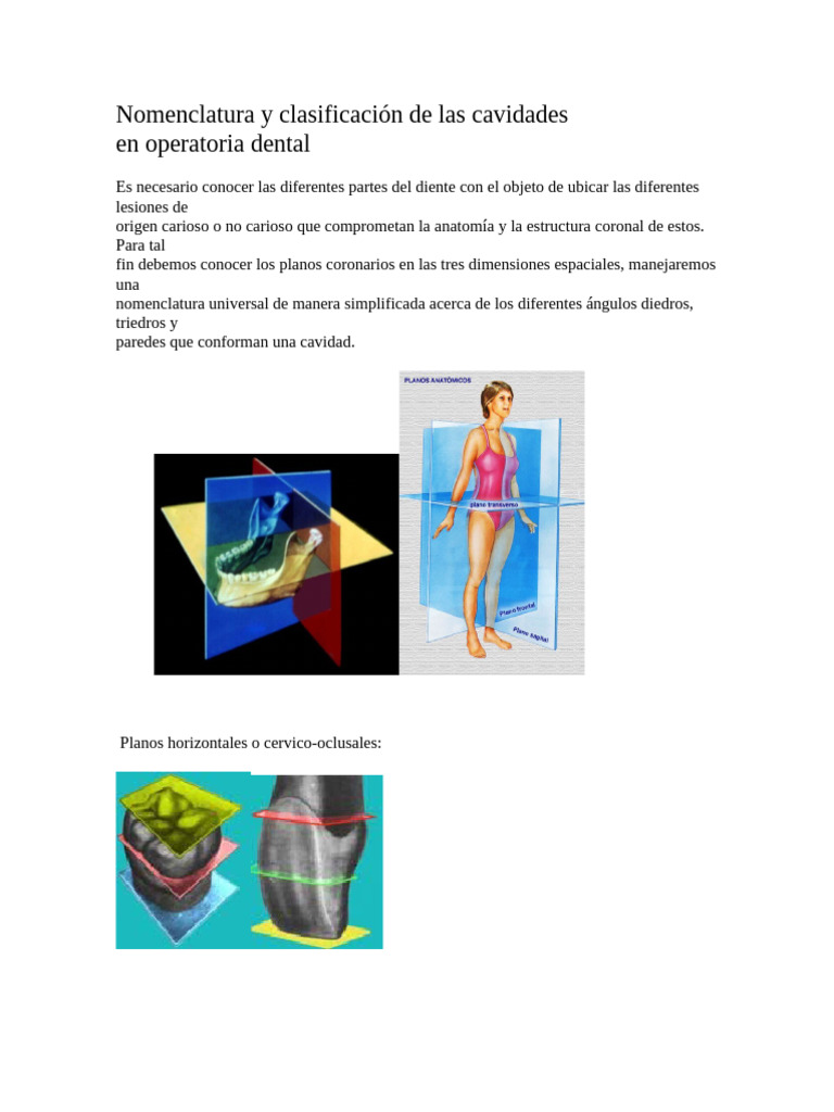 Nomenclatura y clasificación de cavidades dentales | PDF | Diente ...