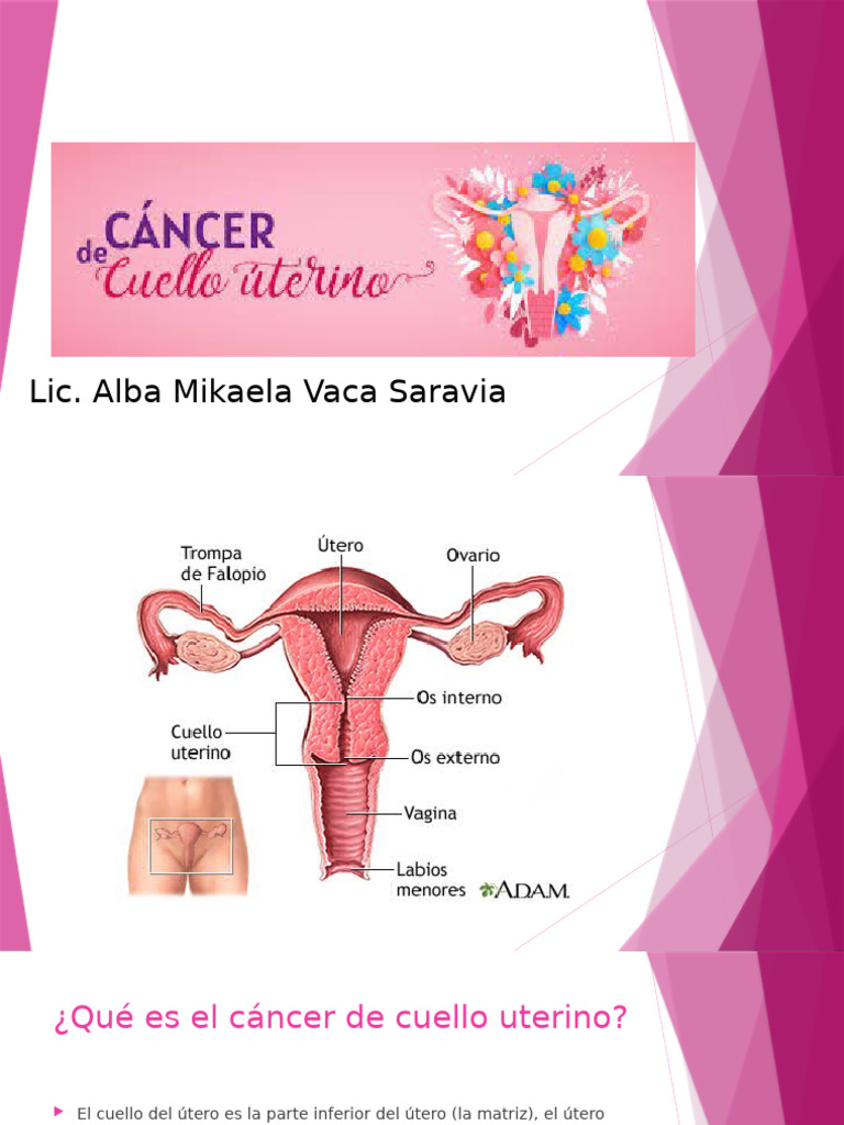 Cancer de Cuello Uterino | PDF