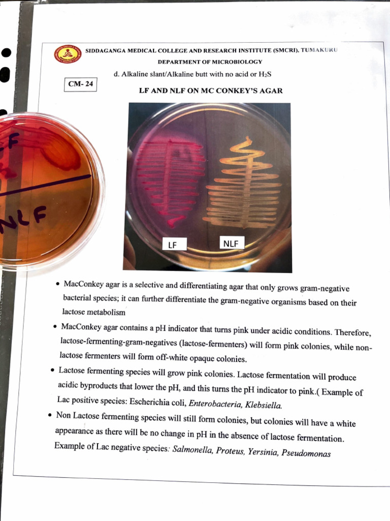 Micro Spotters 1 | PDF