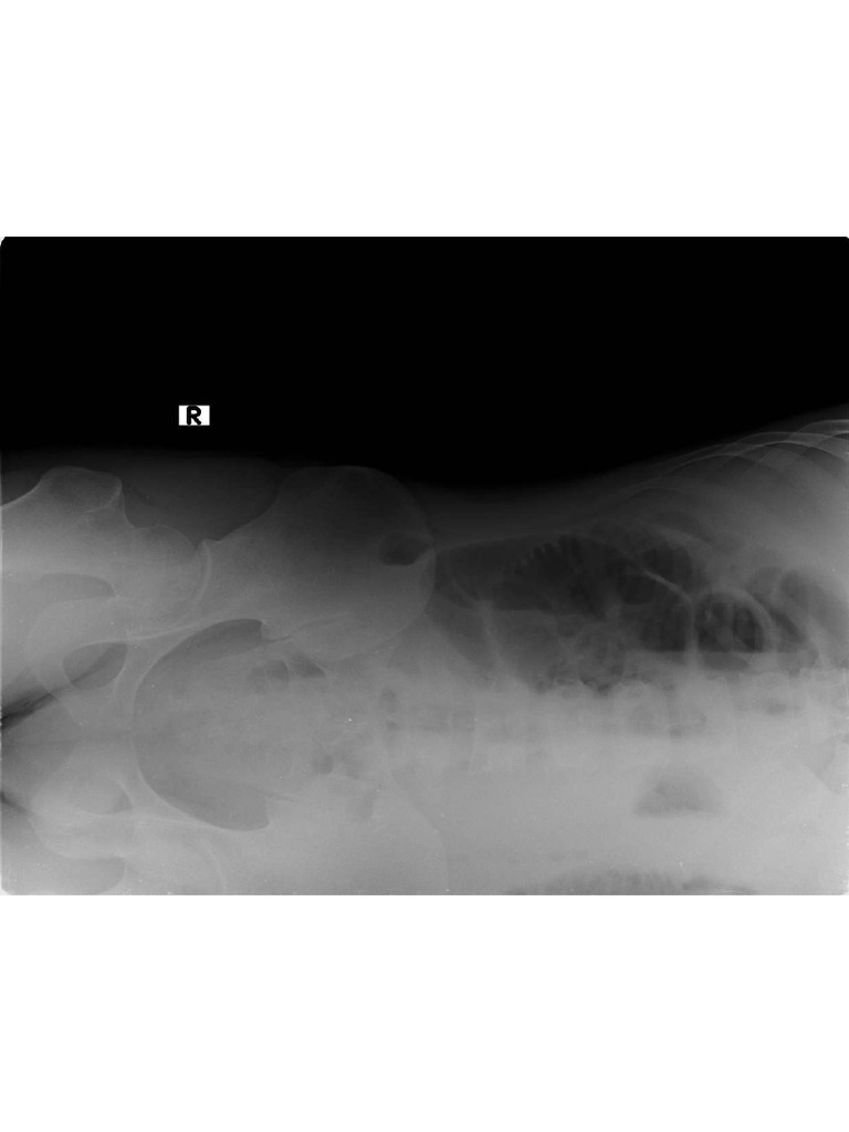 015197 Sdr. Brilyan B.R [LLD]0000 | PDF