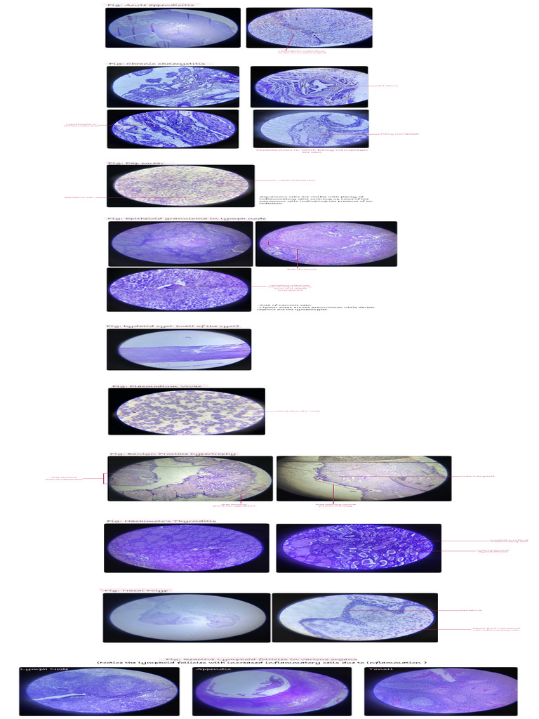 Histopath 2 Compressed | PDF | Lymph Node | Lymphatic System