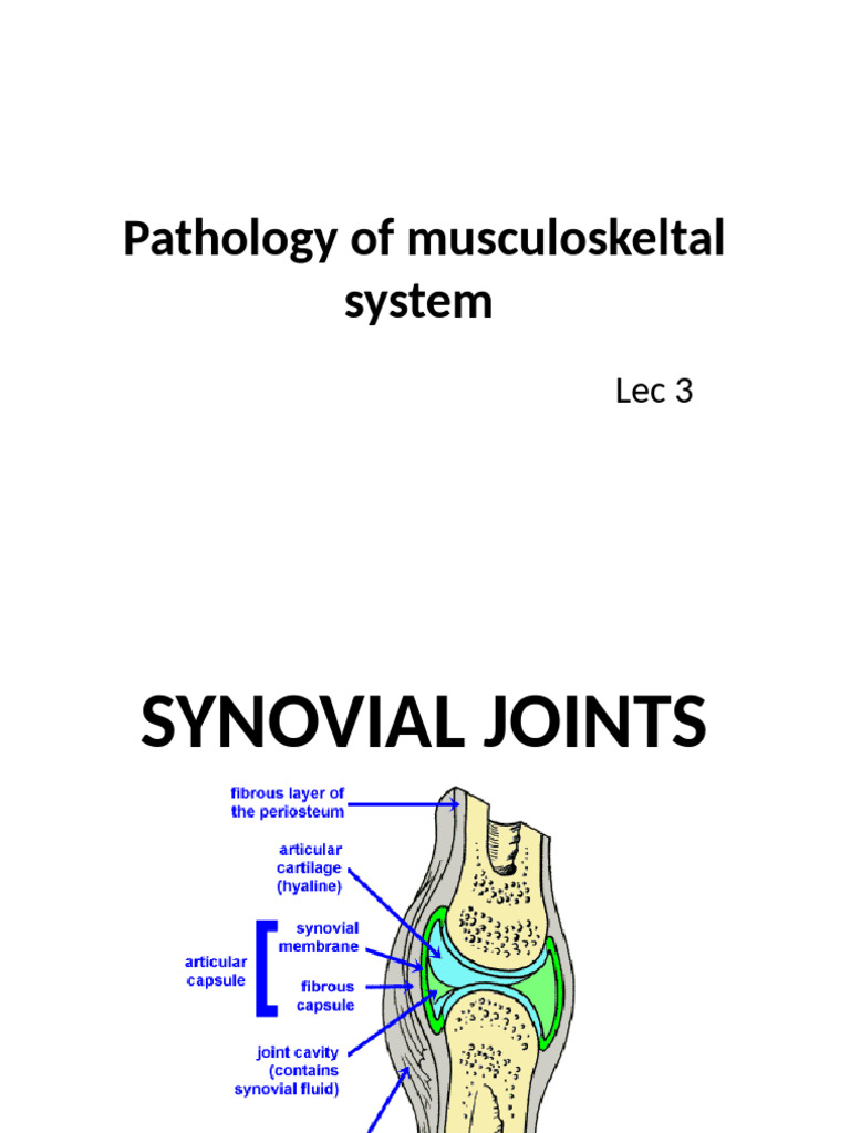 Lec 13....Pathology of Musculoskeletal System (1) | PDF | Gout ...