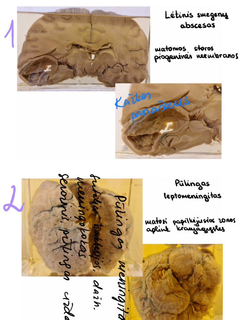 Neuro i 6.3 Makro 2 | PDF