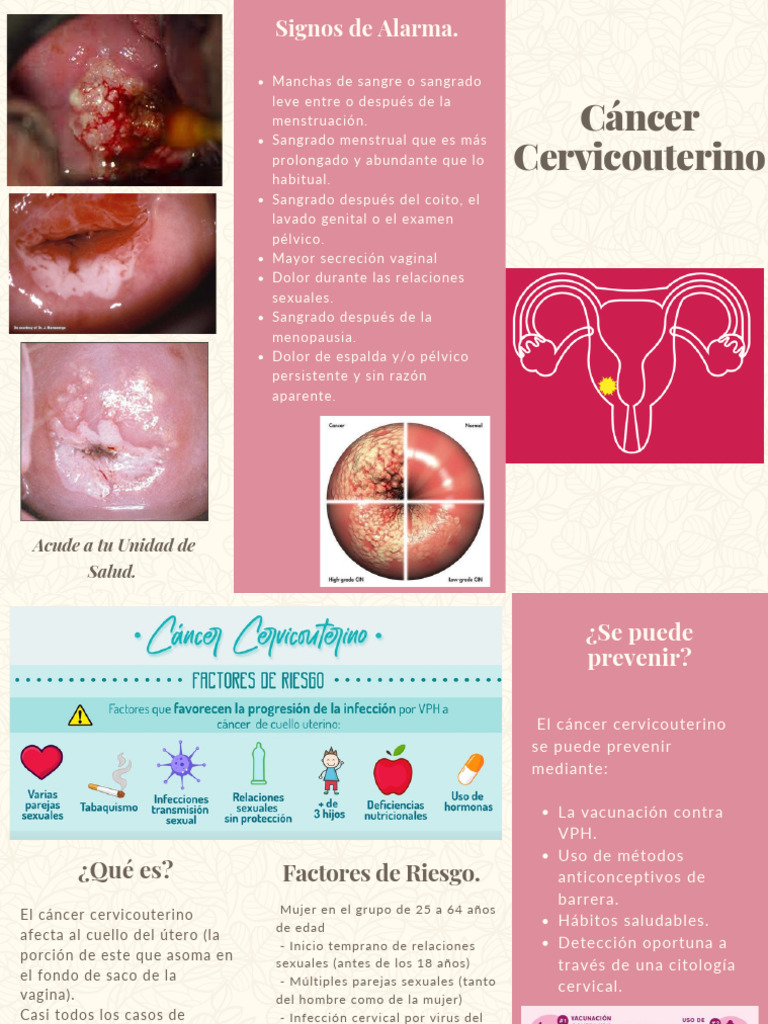 Signos y Prevención del Cáncer Cervical | PDF | Cáncer de cuello ...