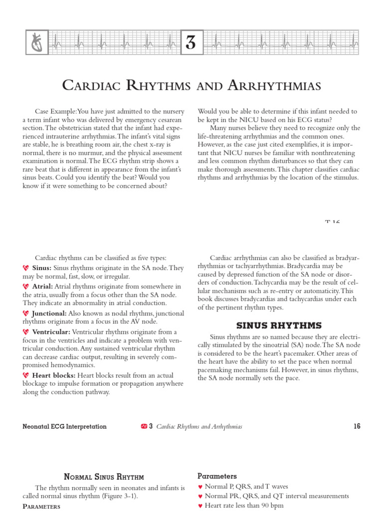 Neonatal ECG: Cardiac Rhythms Guide | PDF | Electrocardiography | Heart