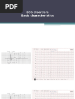 EKG Flash Cards | PDF | Cardiac Arrhythmia | Cardiovascular System