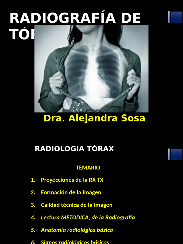 3. Radiografia de torax | PDF | Pulmón | Tórax