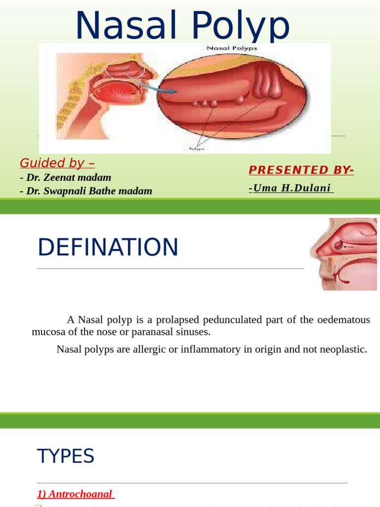 Nasal Polyp Pathology Overview | PDF | Human Nose | Rhinology