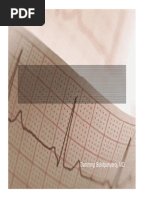 Understanding Left Anterior Fascicular Block | PDF | Circulatory System ...