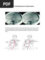 Types of Mortis and Death Determination | PDF | Death | Brainstem