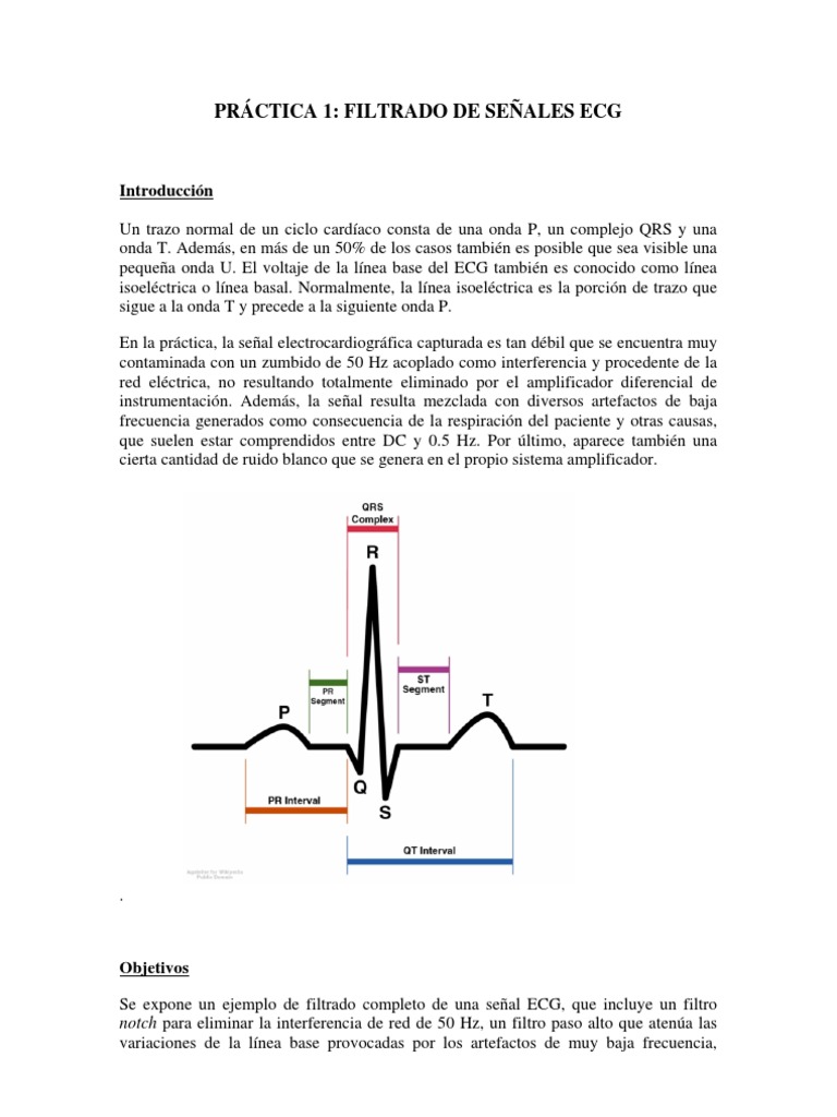 Filtrado ECG | PDF | Wavelet | Electrocardiografia
